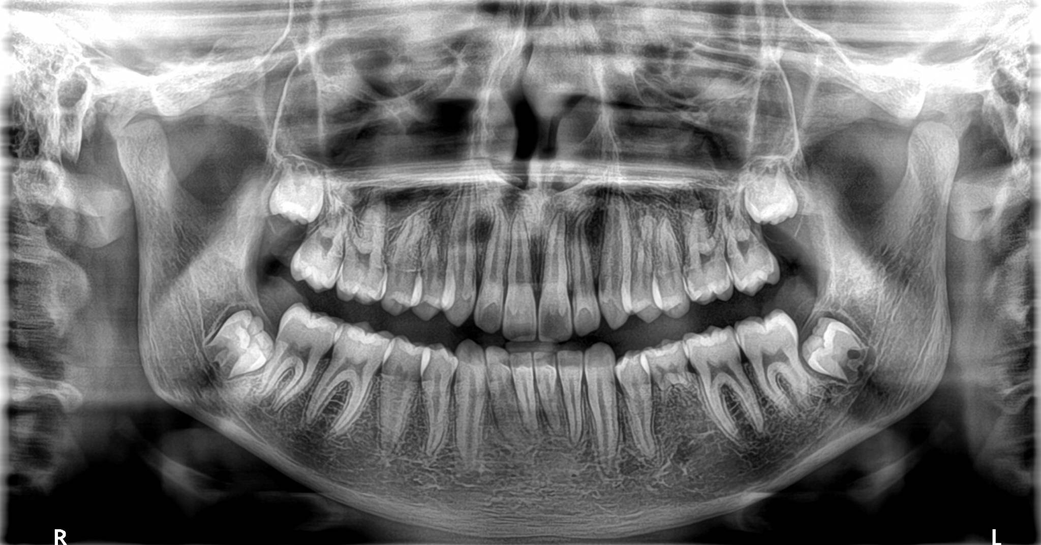 X-Rays – The Orthodontic Centre Limited – Dr. Lue Chee Lip